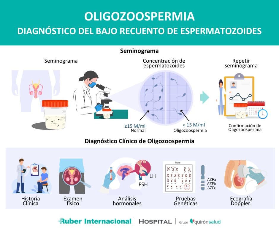 Oligozoospermia: Causas, diagnóstico y tratamiento del bajo recuento de espermatozoides en la ...